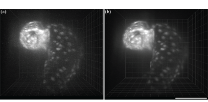 IEEE Life Sciences: Spotlight on Research in Biological Imaging — EN